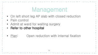 Ankle fracture-by-rgjel | PPT