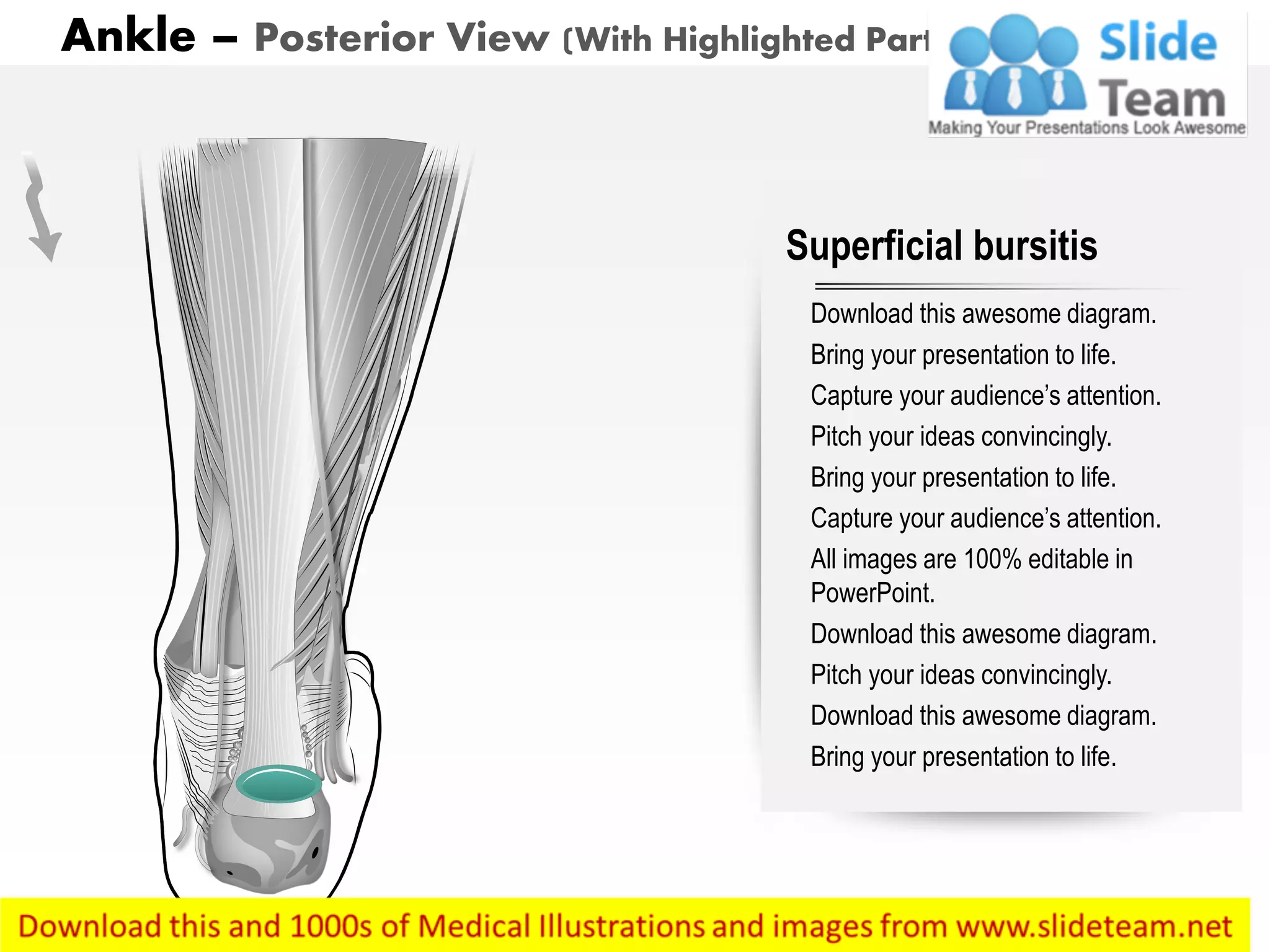 Ankle posterior medical images for power point | PPT