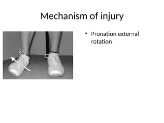 ankle and foot, joints in it and injuries | PPTX