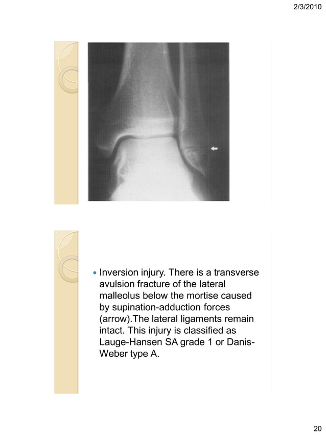 Ankle And Foot | PDF