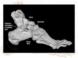 Ankle and Foot Complex biomechanics and its pathology | PPTX