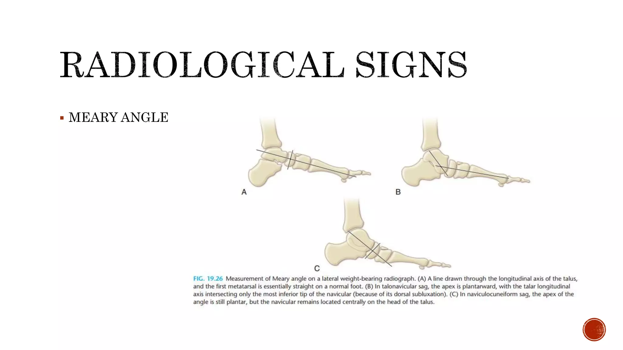 ANKLE AND FOOT DISORDERS.pptx
