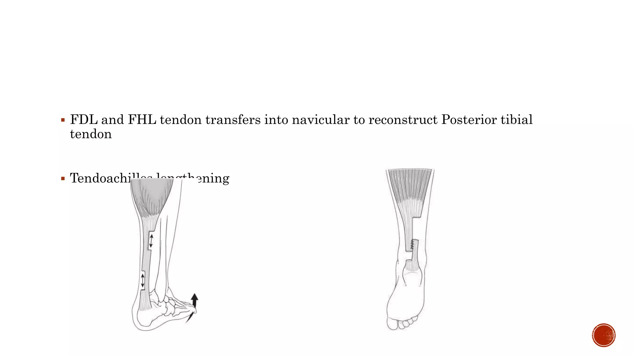 ANKLE AND FOOT DISORDERS.pptx