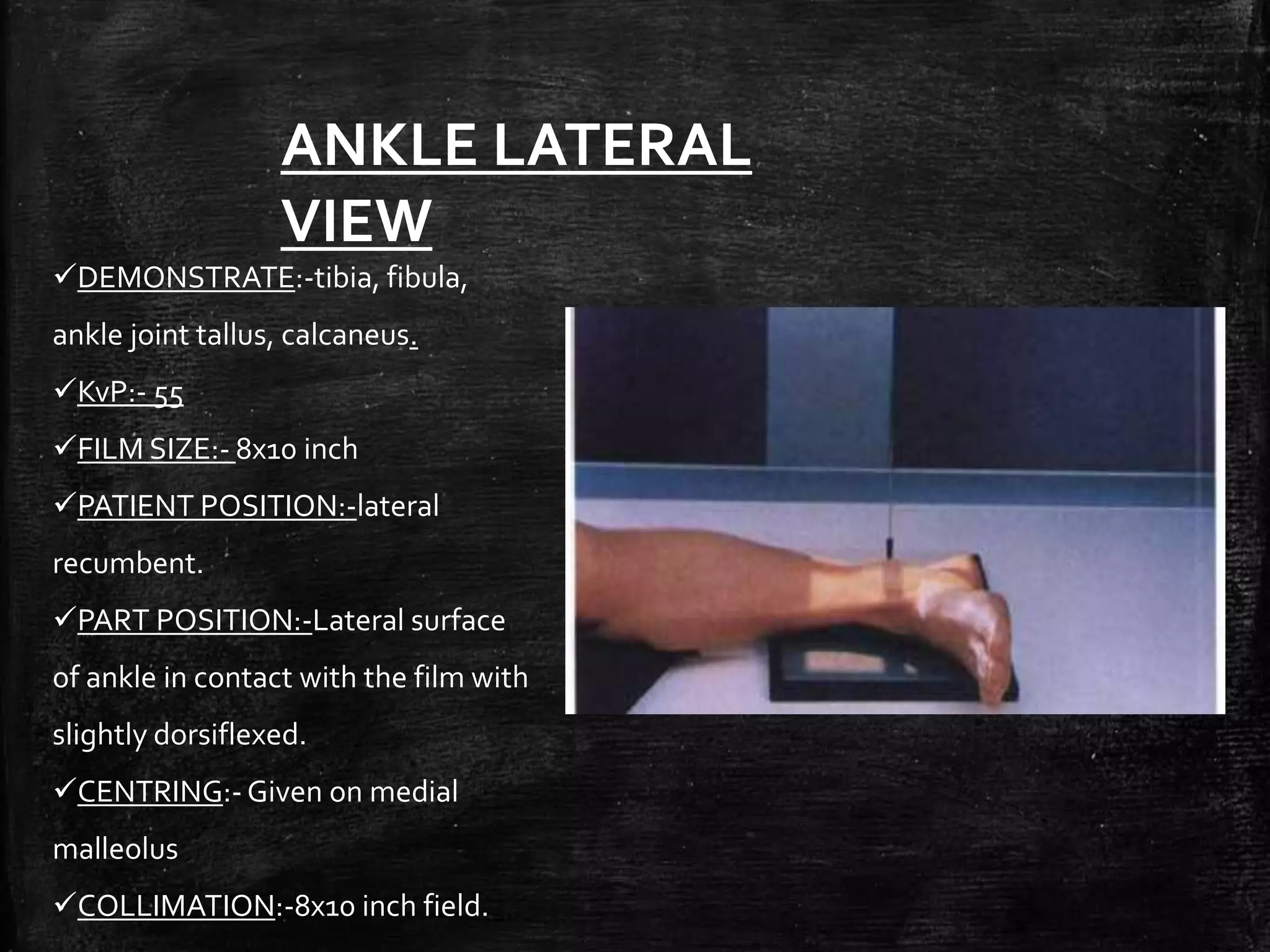 Normal Ankle and foot Radiographs by Dr Avinash | PPTX