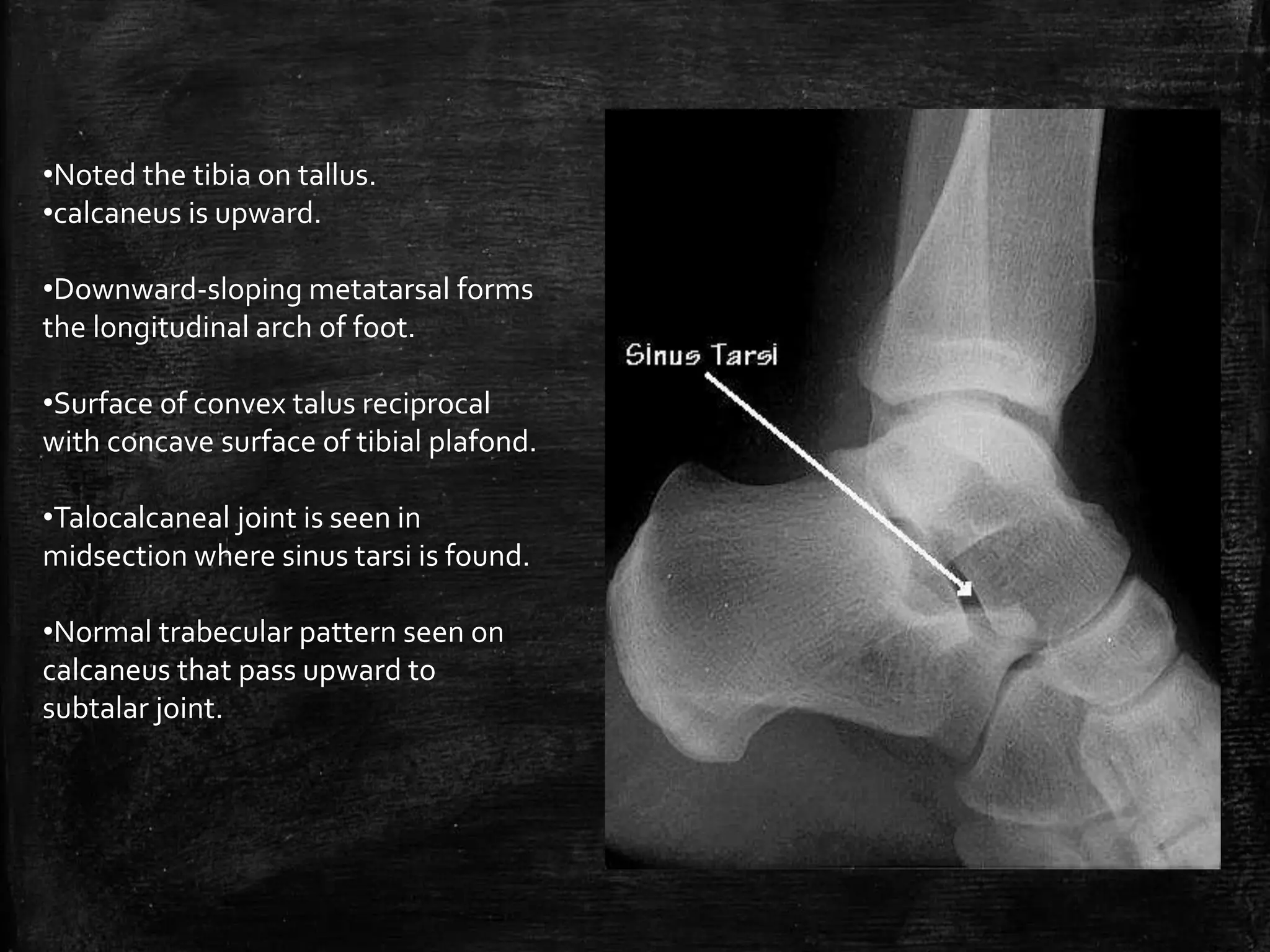 Normal Ankle and foot Radiographs by Dr Avinash | PPTX