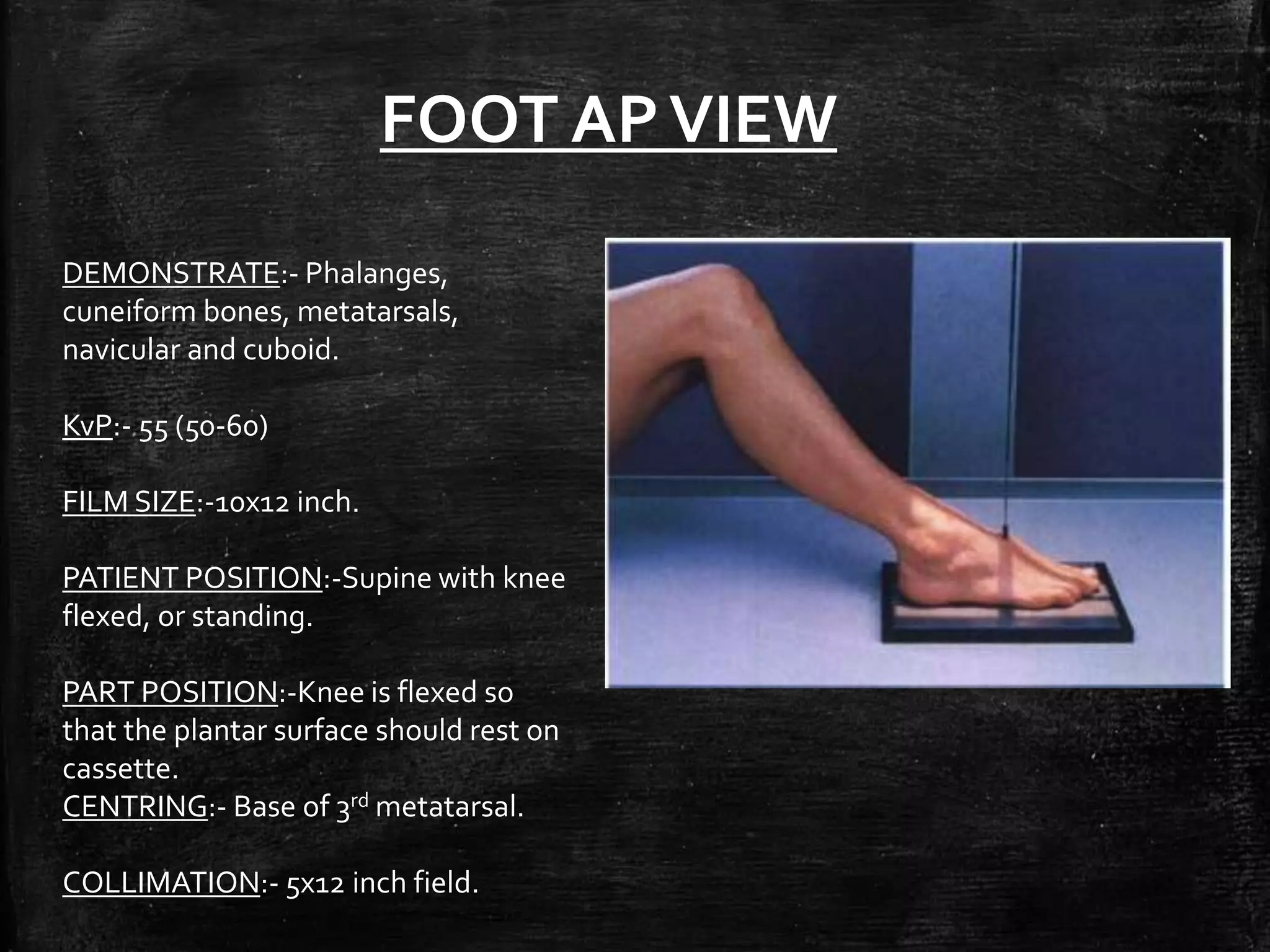 Normal Ankle and foot Radiographs by Dr Avinash | PPTX