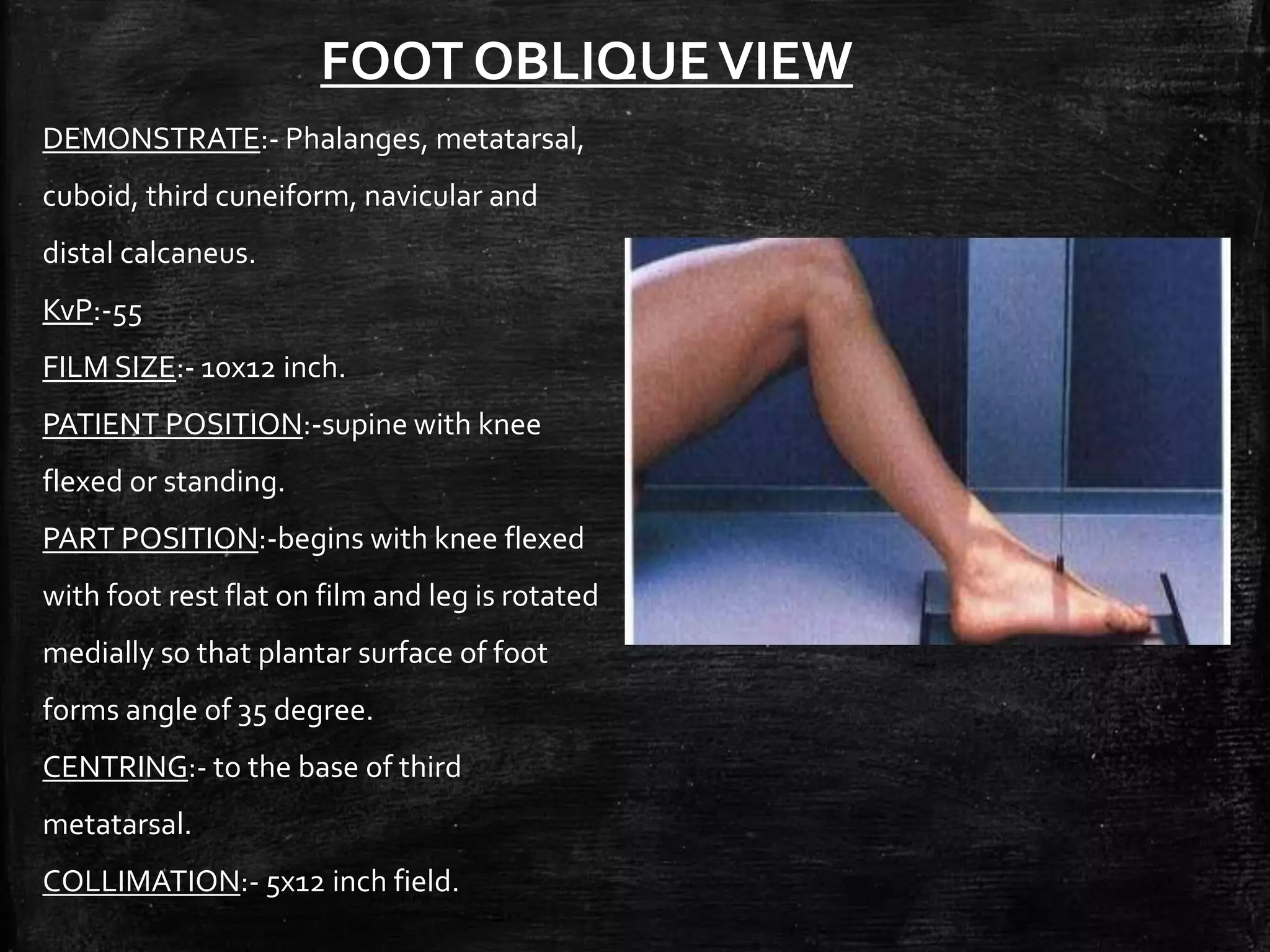 Normal Ankle and foot Radiographs by Dr Avinash | PPTX