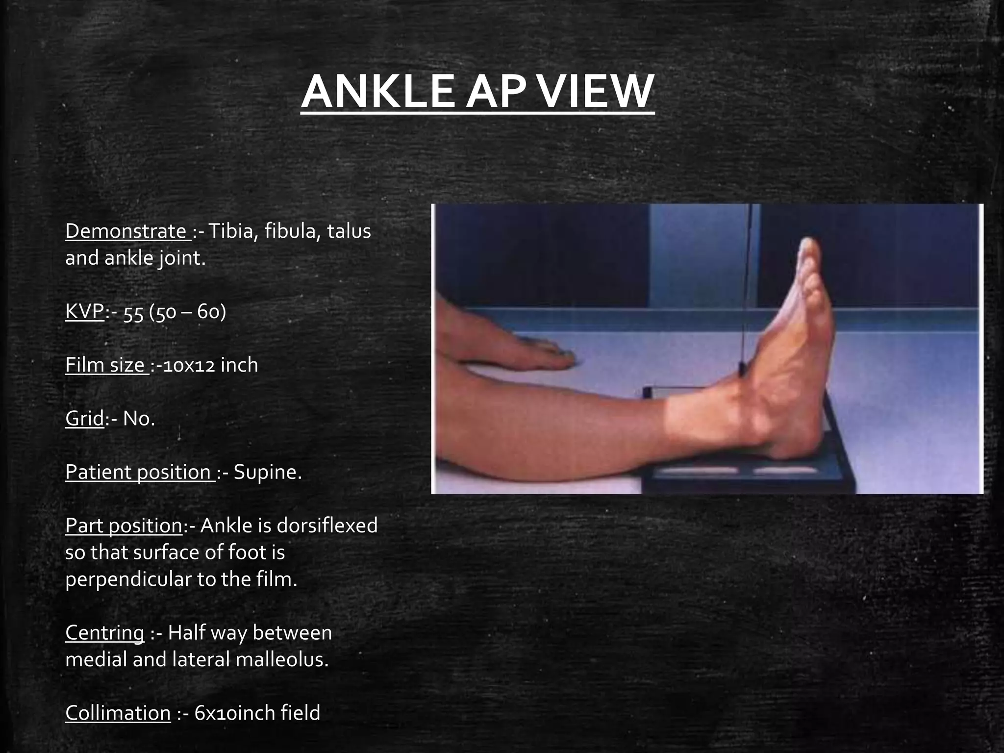 Normal Ankle and foot Radiographs by Dr Avinash | PPTX