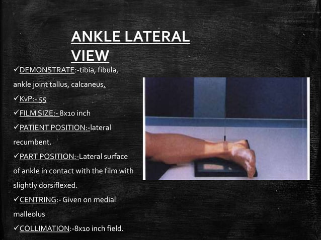 Normal Ankle and foot Radiographs by Dr Avinash | PPTX | Death, Injury ...