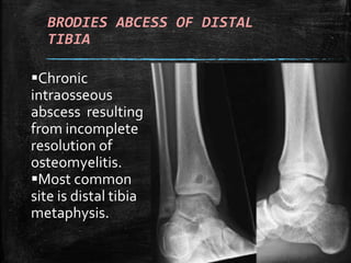 Normal Ankle and foot Radiographs by Dr Avinash | PPTX