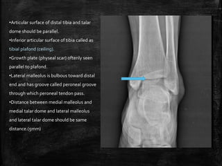Normal Ankle and foot Radiographs by Dr Avinash | PPTX