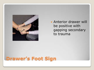 Ankle and foot exam gsp | PPTX