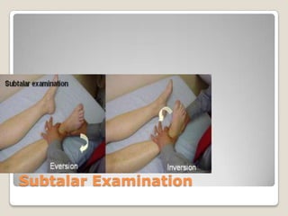 Ankle and foot exam gsp | PPTX
