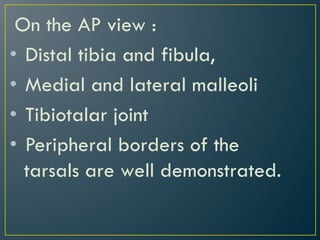 ankle and foot imaging and indications for it | PDF