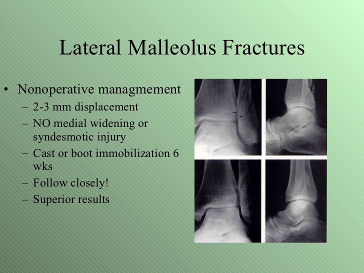 Orthopedics 5th year, 9th lecture (Dr. Ali A.Nabi)