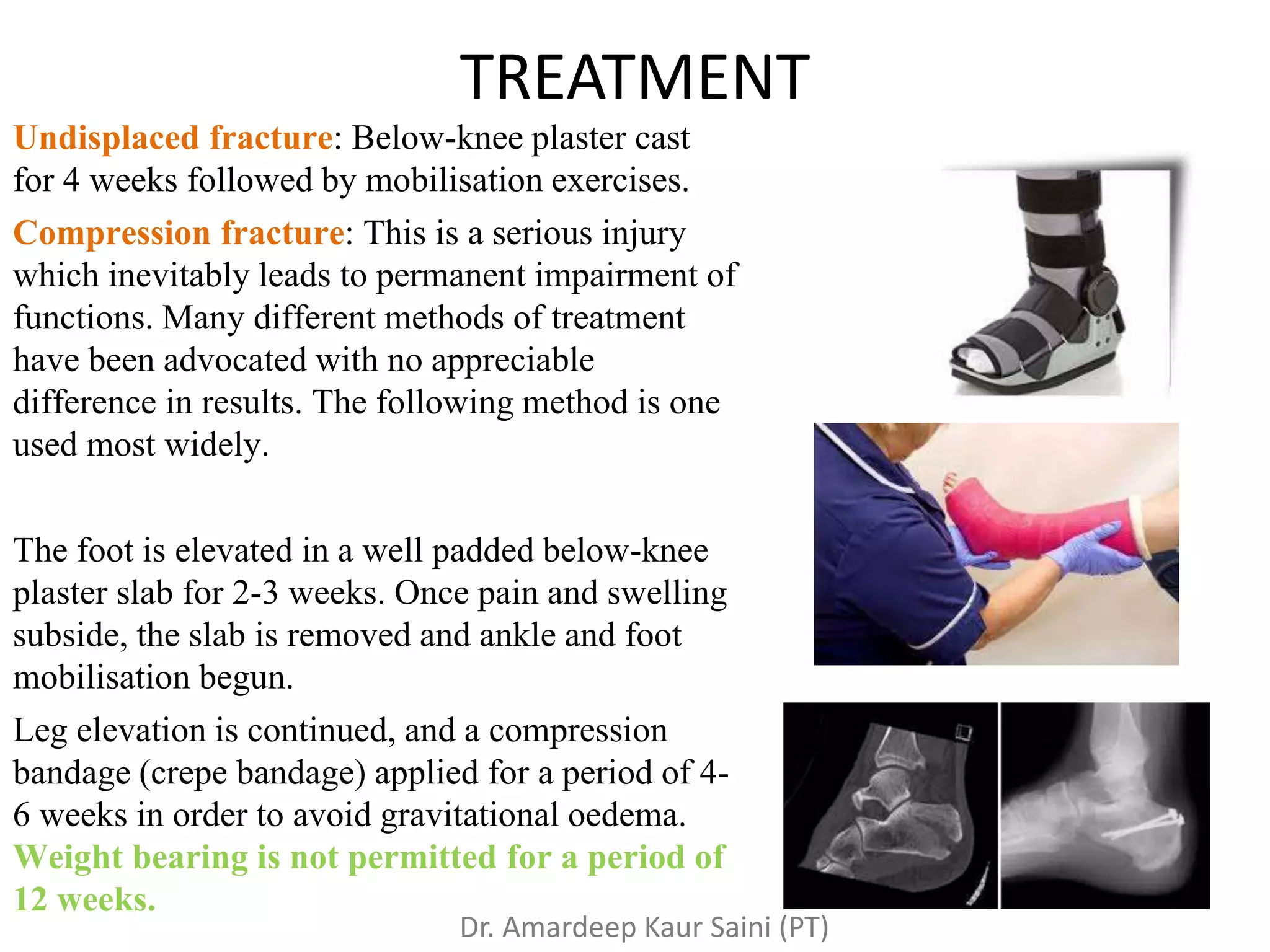 Ankle and foot injuries | PPTX
