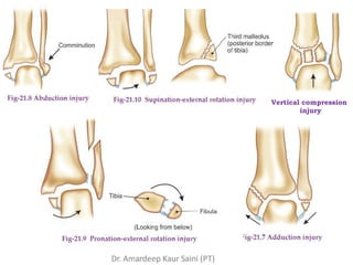Ankle and foot injuries | PPTX