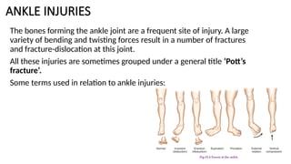 ANKLE AND FOOT INJURIES // Treatment .pptx