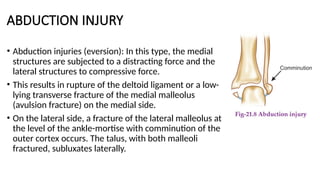 ANKLE AND FOOT INJURIES // Treatment .pptx