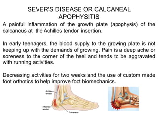 Ankle and foot pain | PPTX