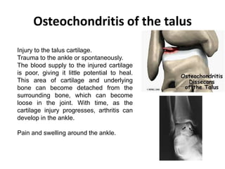 Ankle and foot pain | PPTX