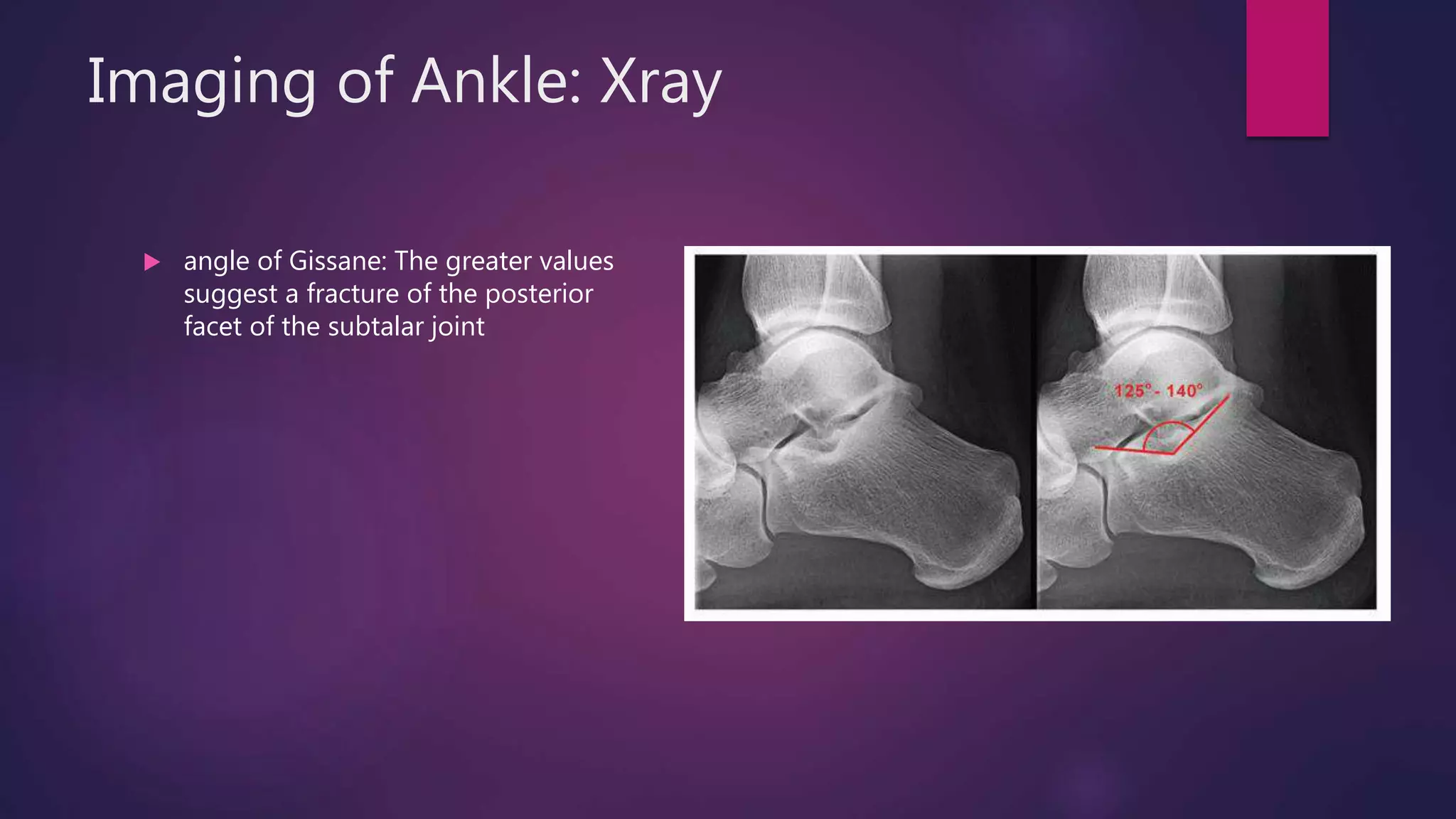 Ankle and Foot | PPTX