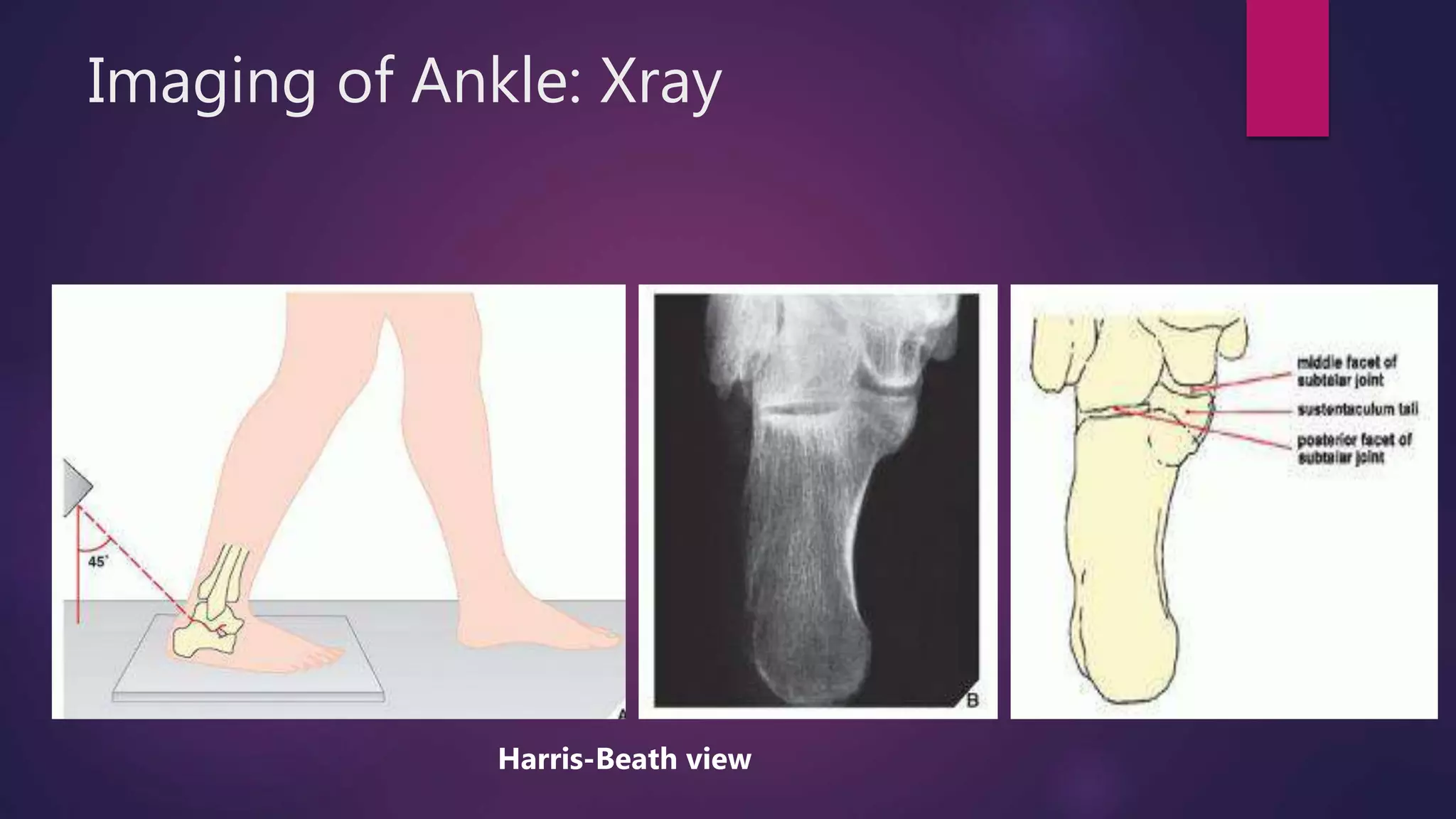 Ankle and Foot | PPTX