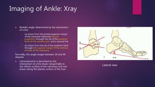 Ankle and Foot | PPTX
