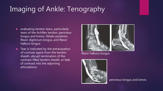 Ankle and Foot | PPTX