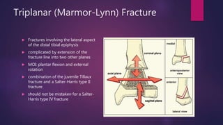 Ankle and Foot | PPTX