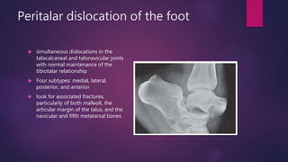 Ankle and Foot | PPTX