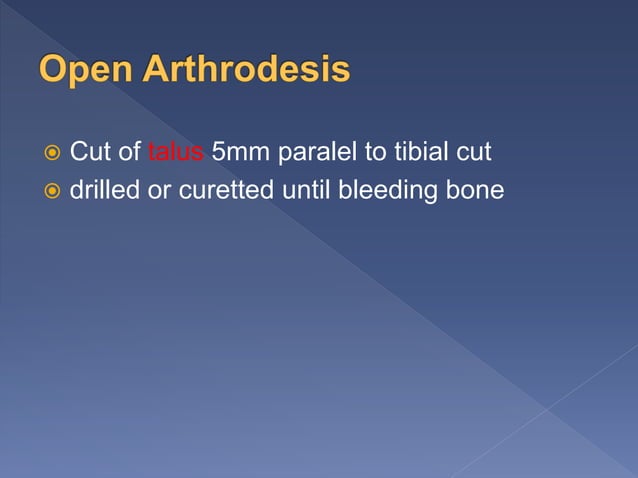 Ankle Arthodesis.pptx
