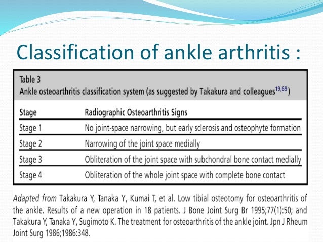 Ankle arthrodesis