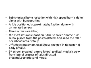 Ankle arthrodesis | PPTX