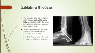 Ankle Arthrodesis.pptx