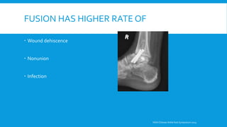 Ankle Arthrodesis, Approach and Surgical Techniques.pptx
