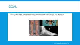 Ankle Arthrodesis, Approach and Surgical Techniques.pptx