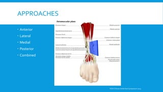Ankle Arthrodesis, Approach and Surgical Techniques.pptx