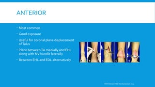 Ankle Arthrodesis, Approach and Surgical Techniques.pptx
