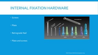 Ankle Arthrodesis, Approach and Surgical Techniques.pptx