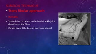 Ankle arthrodesis anterior approach and trans fibular approach which is ...