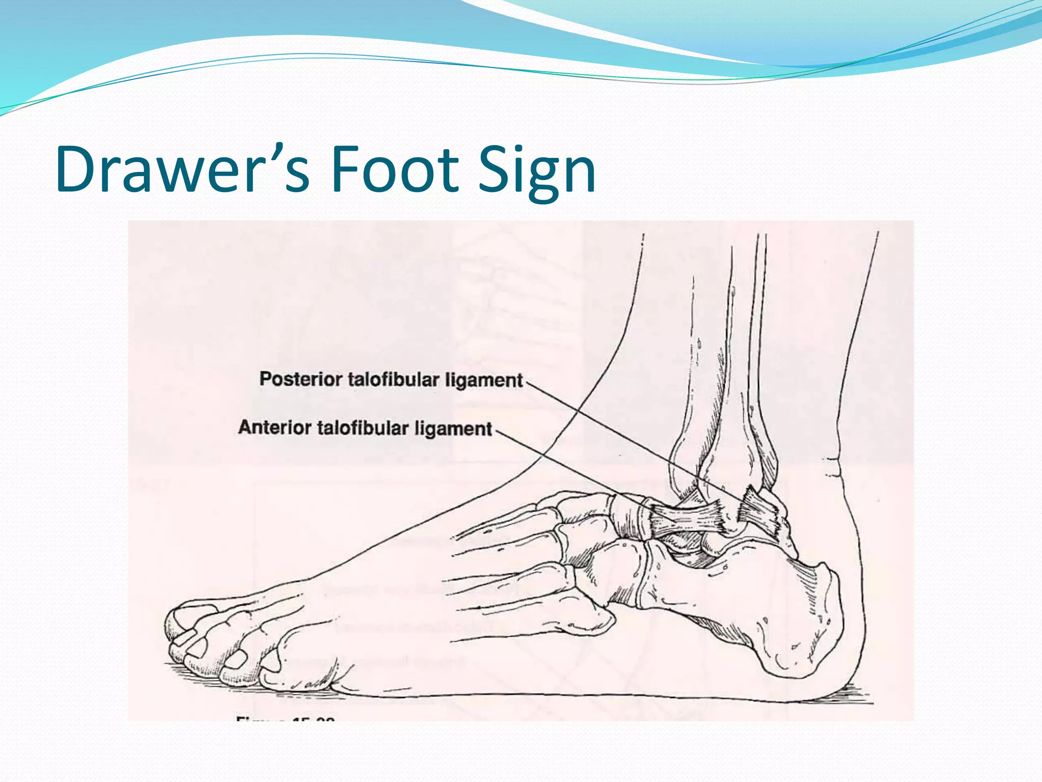 Examination evaluation & Assessment of Ankle & Foot | PPTX