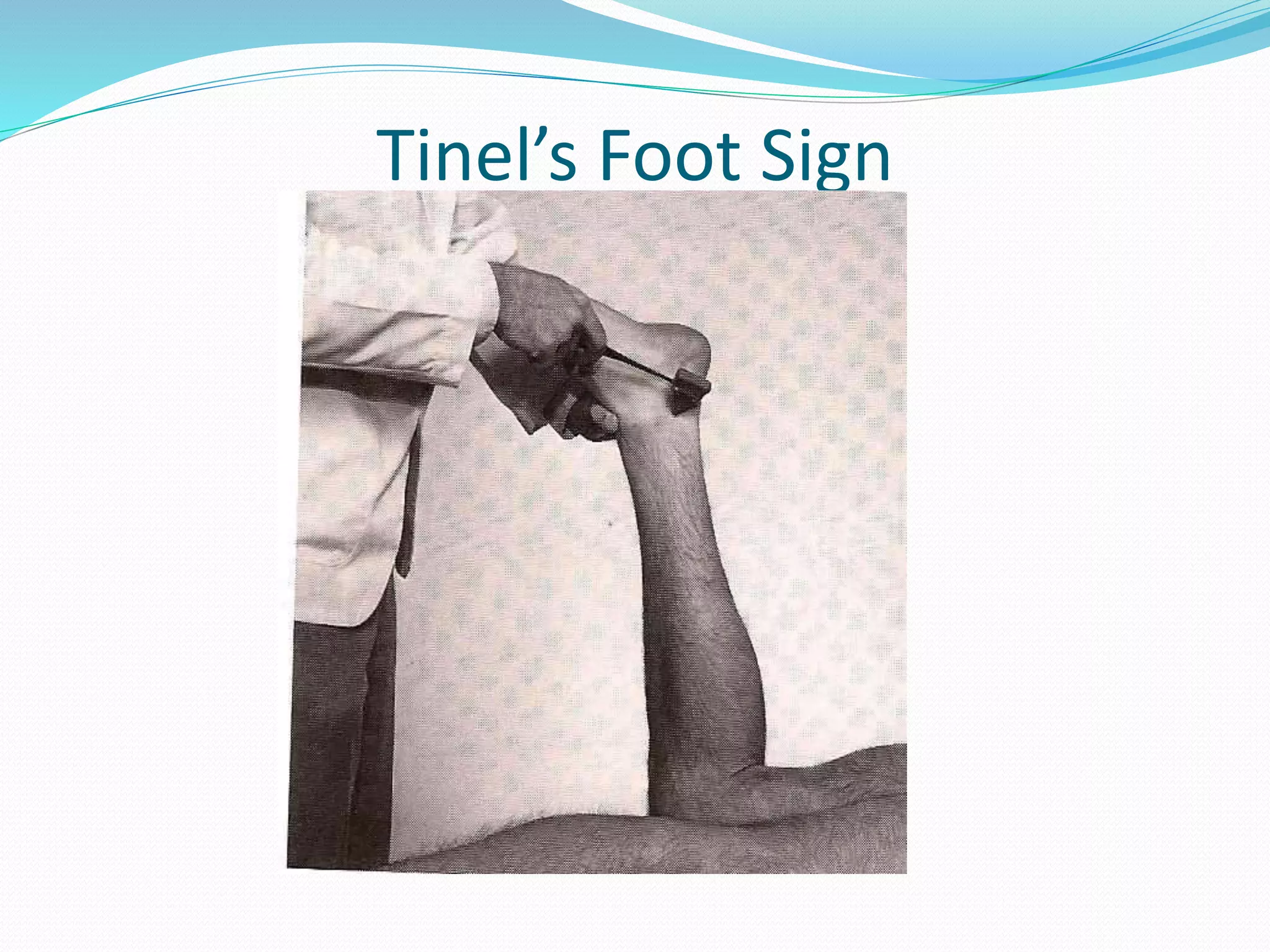 Examination evaluation & Assessment of Ankle & Foot | PPTX
