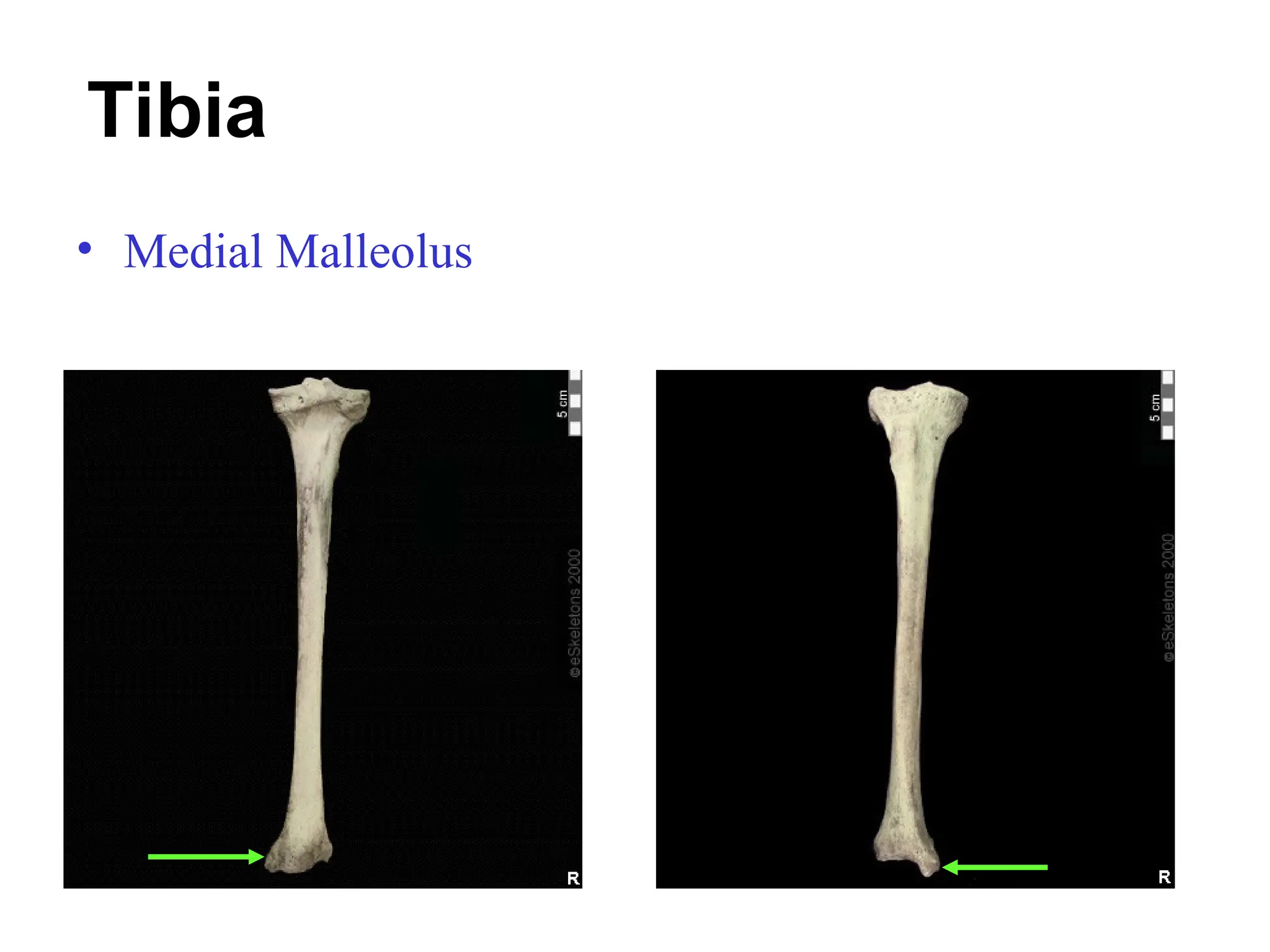 ankle_bone (1).ppt anatomy for foot drop | PPT