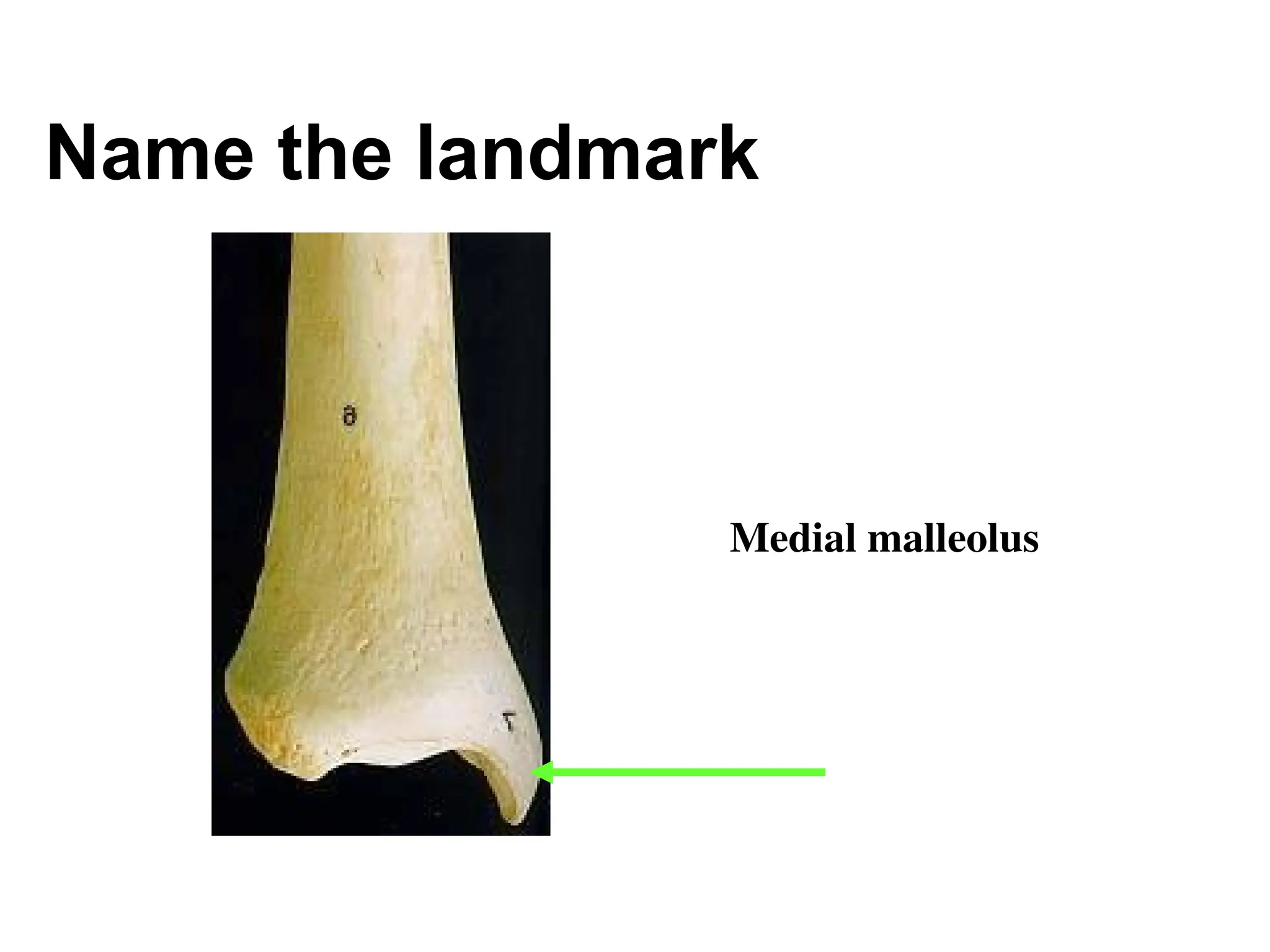 ankle_bone (1).ppt anatomy for foot drop | PPT