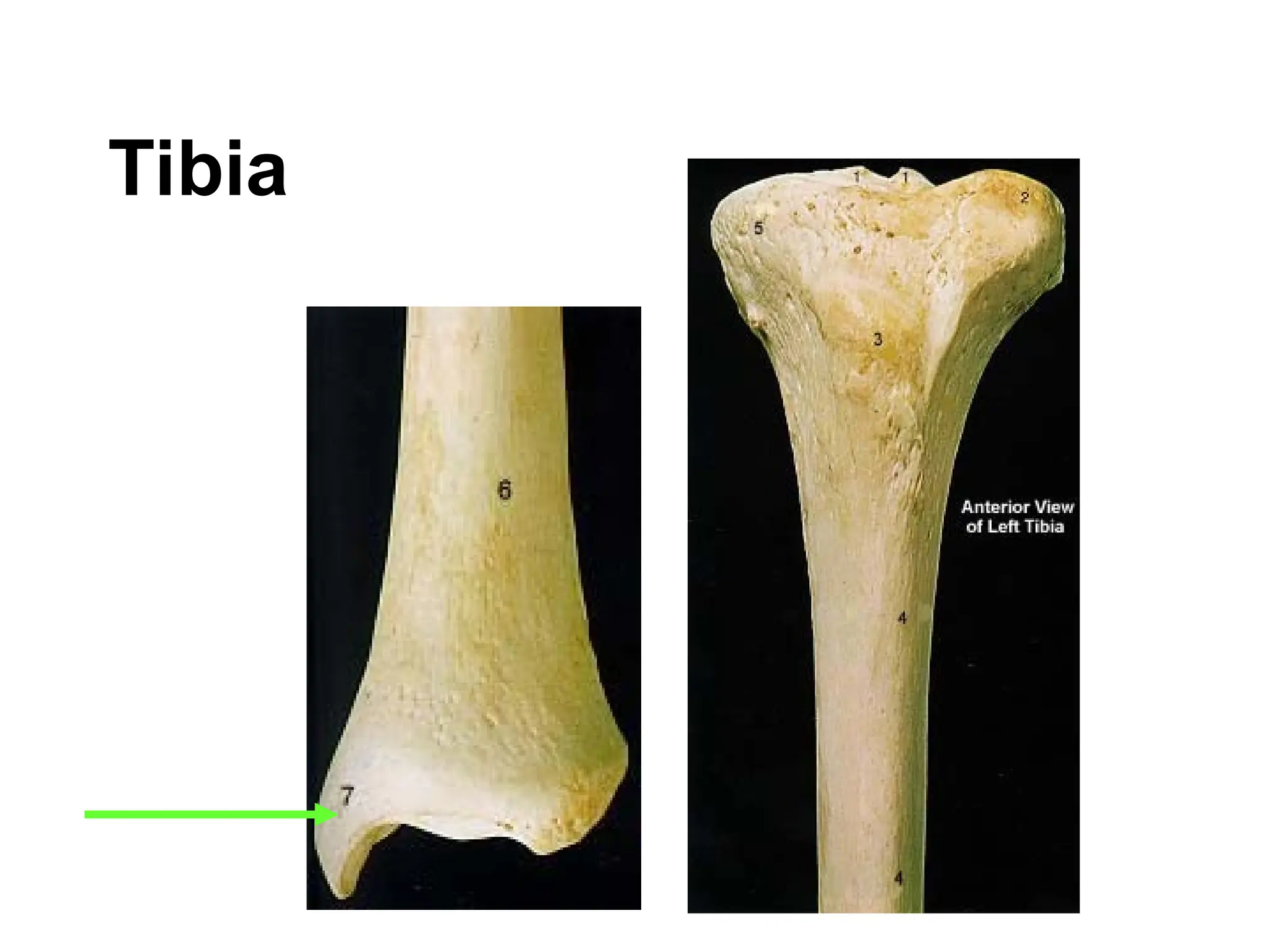 ankle_bone (1).ppt anatomy for foot drop | PPT