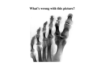 ankle_bone (1).ppt anatomy for foot drop | PPT