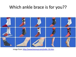 Ankle braces in the treatment of ankle sprains | PPTX