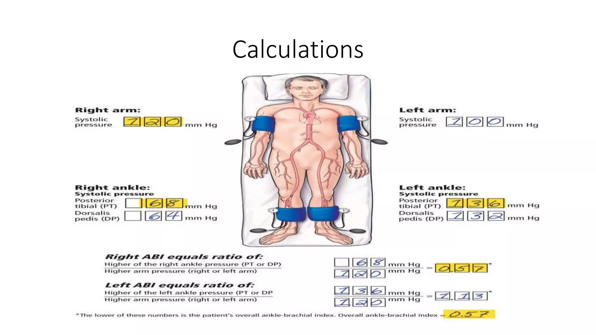 Ankle brachial pressure index (ABPI) | PPTX