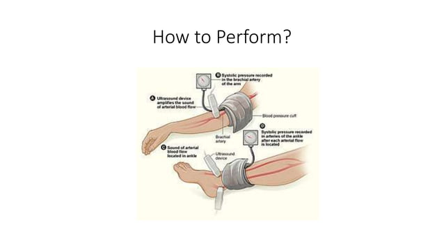 Ankle brachial pressure index (ABPI) | PPTX | Foot Health | Diseases ...